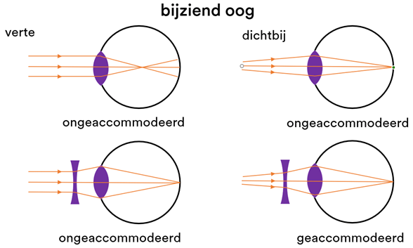 Oogafwijking: Bijziend oefenen | StudyGo
